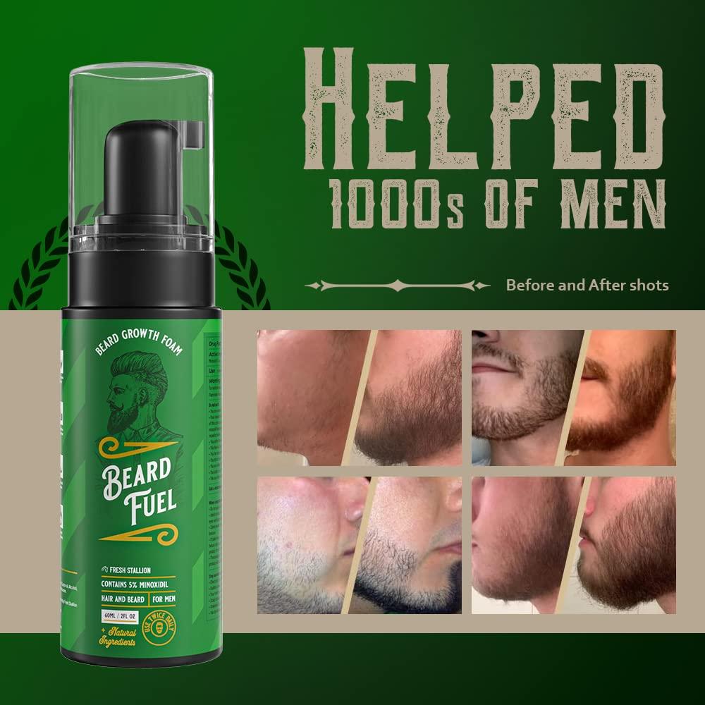 Beard Growth Foam 5% Minoxidil with Biotin - 3 Month Supply | Beard Fuel Hair Follicle Growth ...
