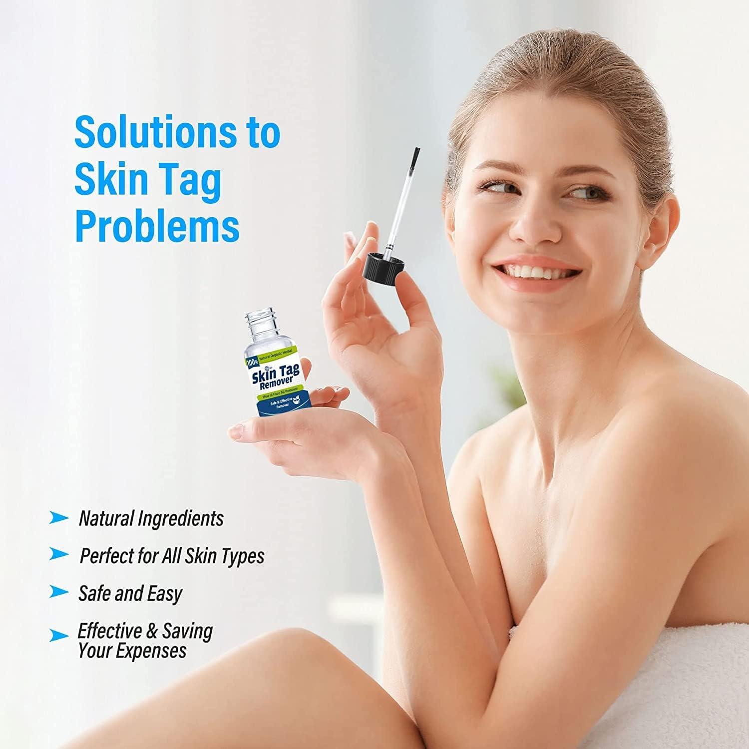 Skin-Tag-Remov-al-Skin-Tag-Remover Wart & Mole-Remover Lotion Fast ...