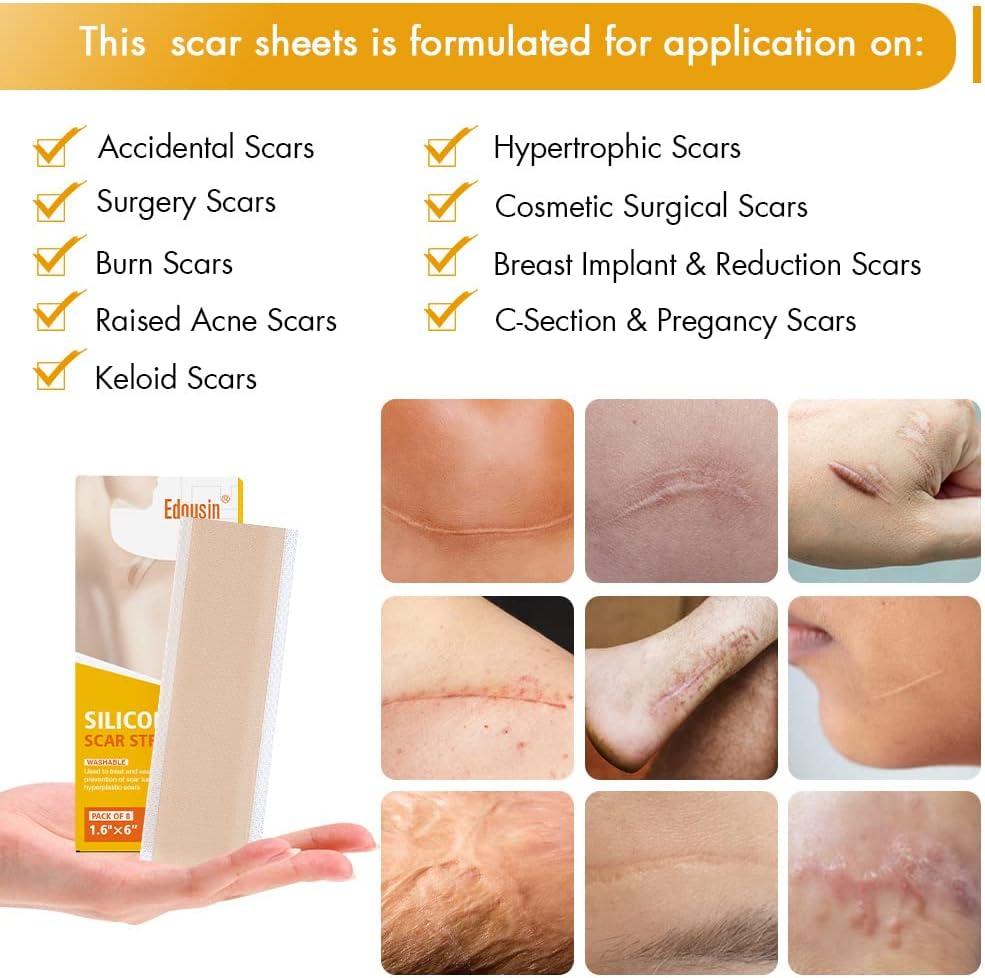 Silicone Scar Strips 1.6 x 6 Multi-Use Cream 8 Pcs - Reusable Scar ...