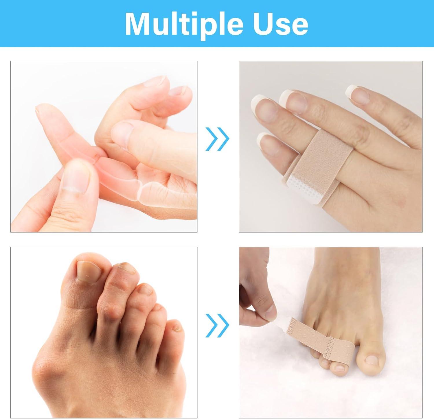 10Pcs Finger Splints for Mallet, Curled and Broken Fingers - Medically ...