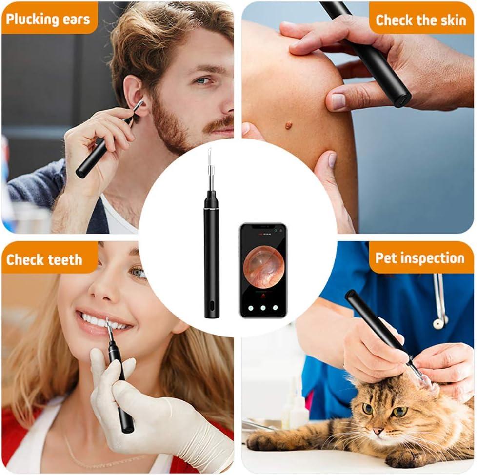Wireless HD Ear Cleaner - 1080p Endoscope Otoscope with 6 LED Lights ...