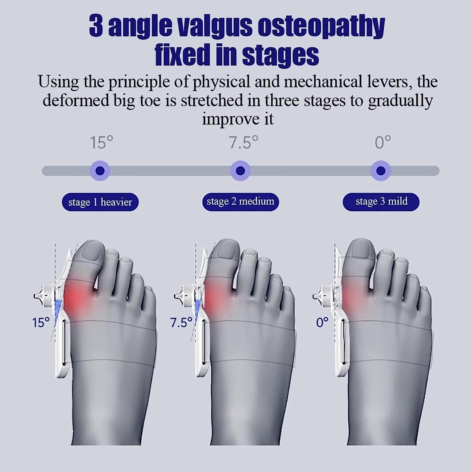 Orthopedic Bale Toe Corrector for Men & Women | Adjustable Flat Iron ...