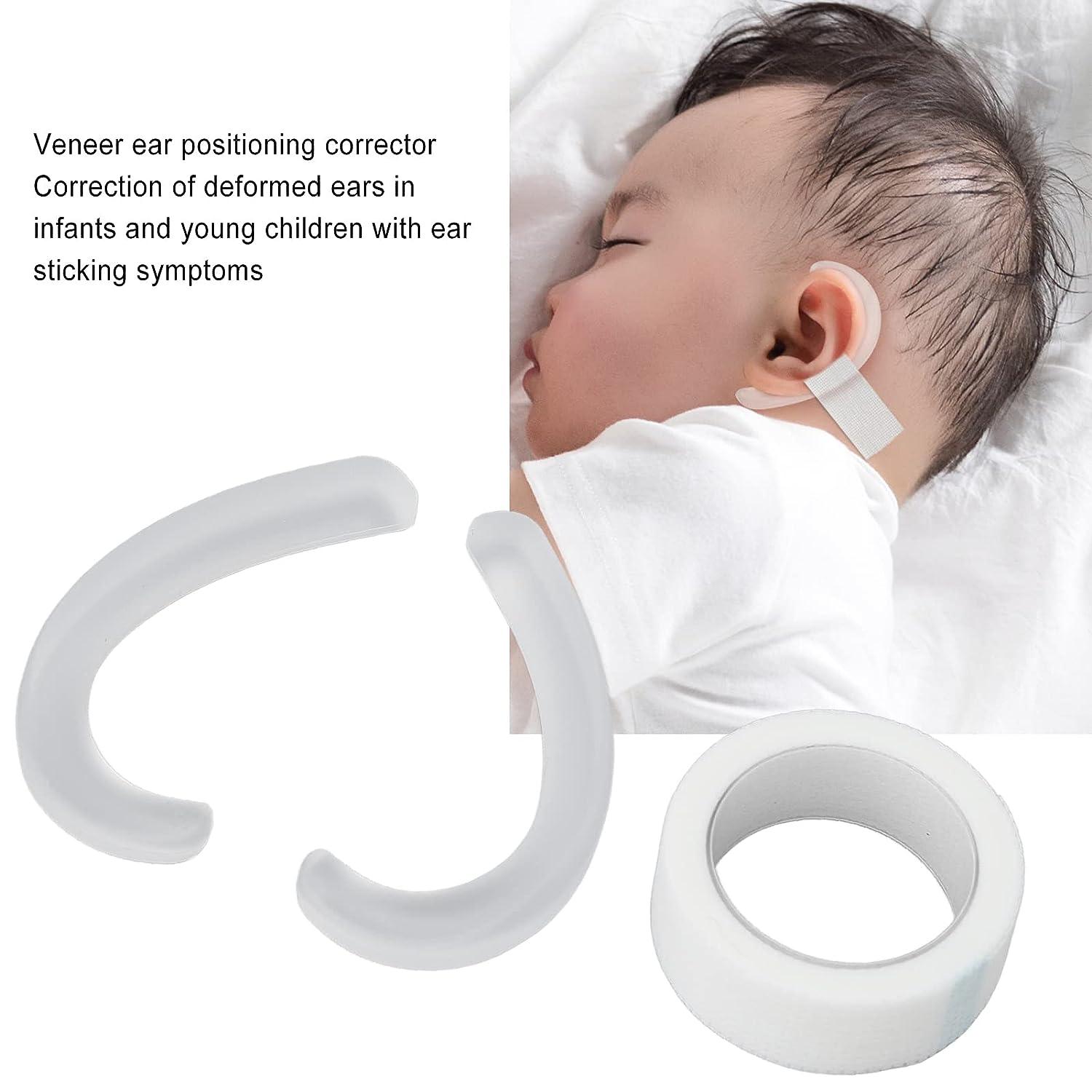 Infant Ear Corrector with Locator | Gentle Baby Ear Tape | Deformed Ear ...