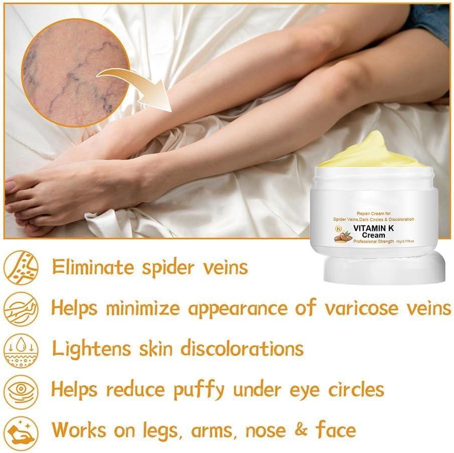 Fivfivgo Varicose Veins Miracle Cream | Pain Relief for Legs & Spider ...