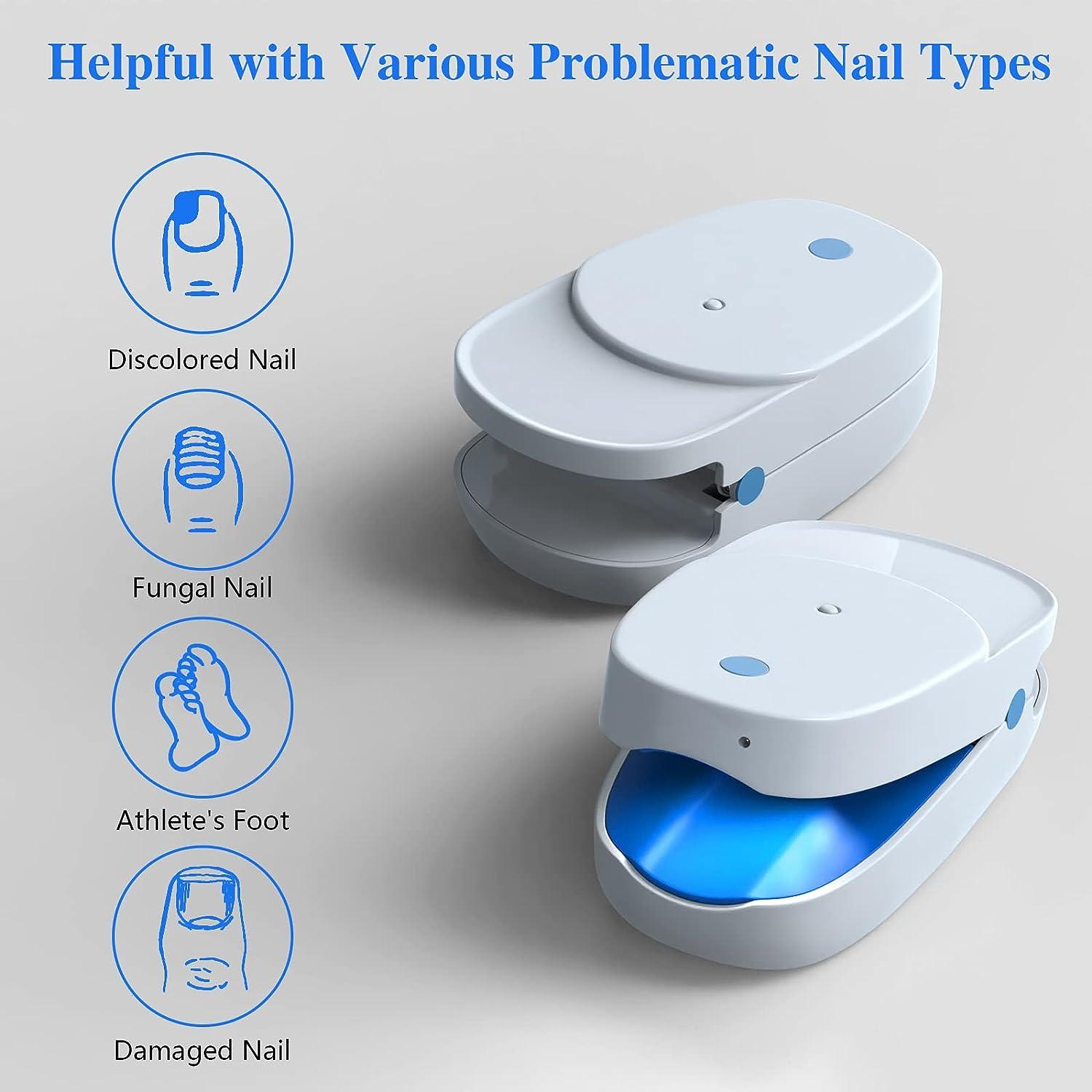 Effective Toenail Fungus Laser Remover Device for Onychomycosis ...