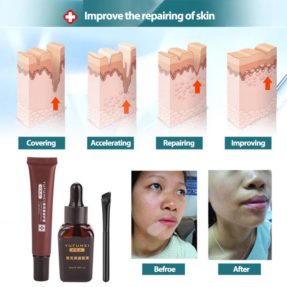 Cimenn Professional Vitiligo Cover Liquid Set - Scar & Birthmark ...