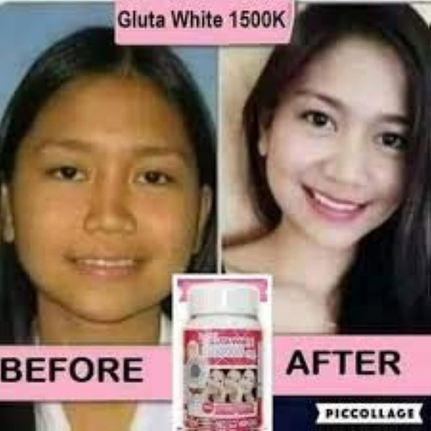 Supreme Gluta White 1500000mg Whitening & Anti Aging Capsules - Reduce ...