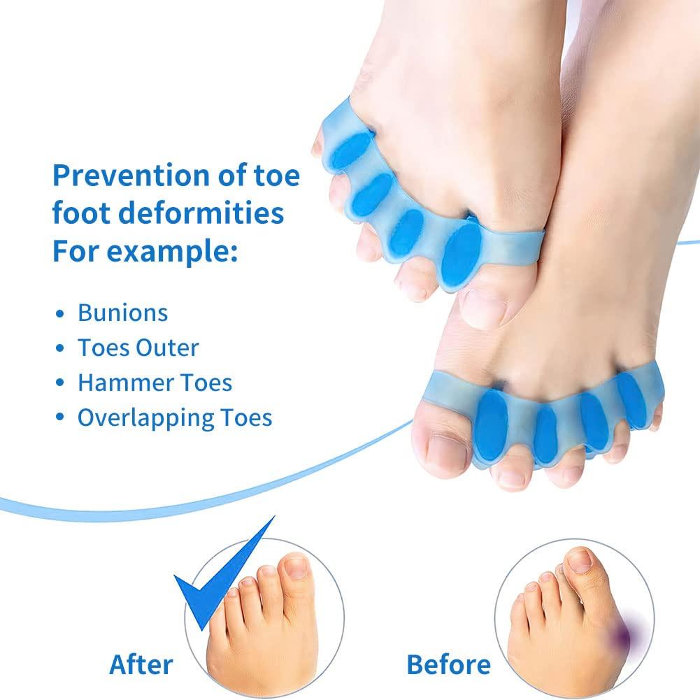 AGARES Toe Spacers (8-Piece Set) | Bunions Correction for Women & Men ...