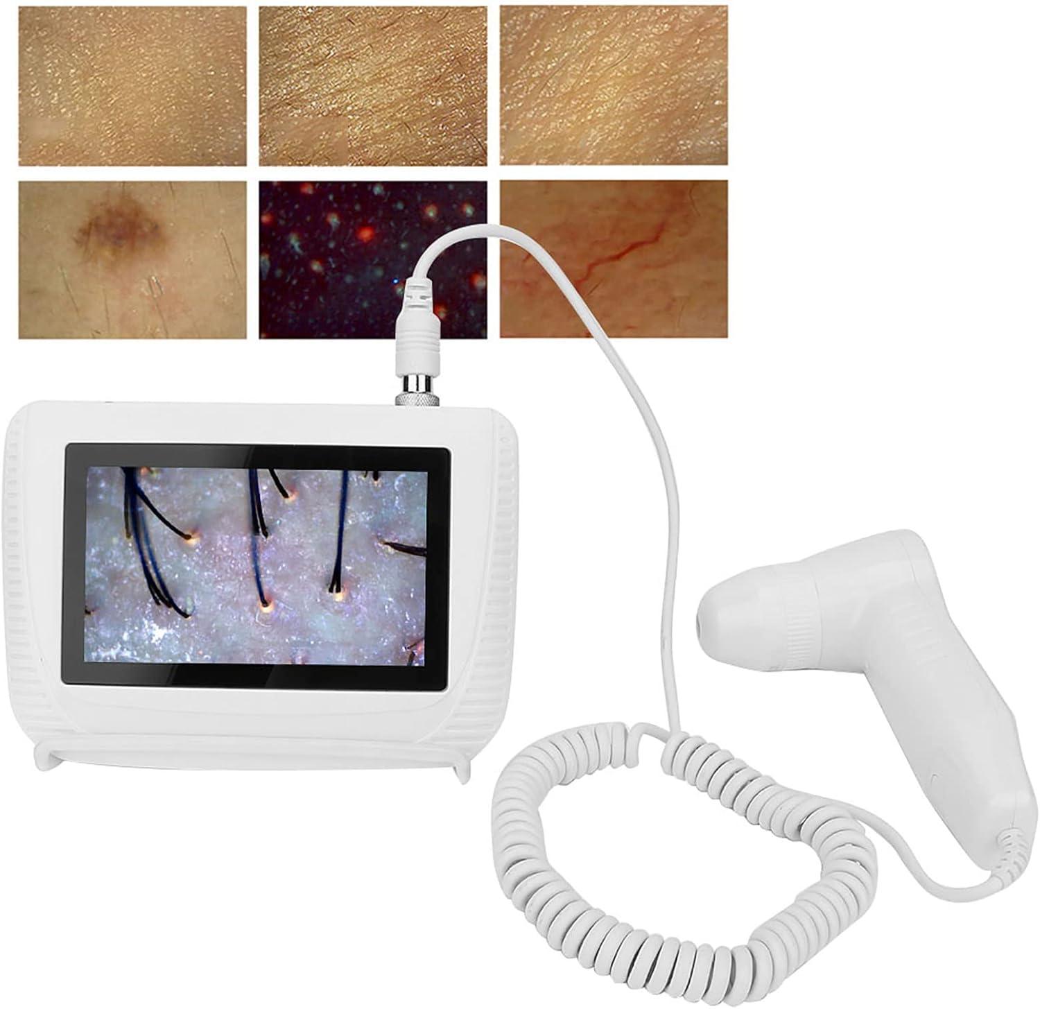 Asixxsix Skin Diagnosis Hair Analyzer | 5 Inch LCD Digital Tester for ...