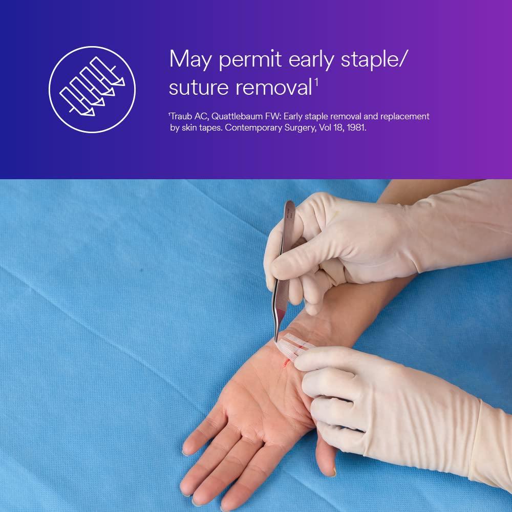 3M Steri-Strip Reinforced Skin Closures R1547 - 1/2 x 4 - 6 Strips ...