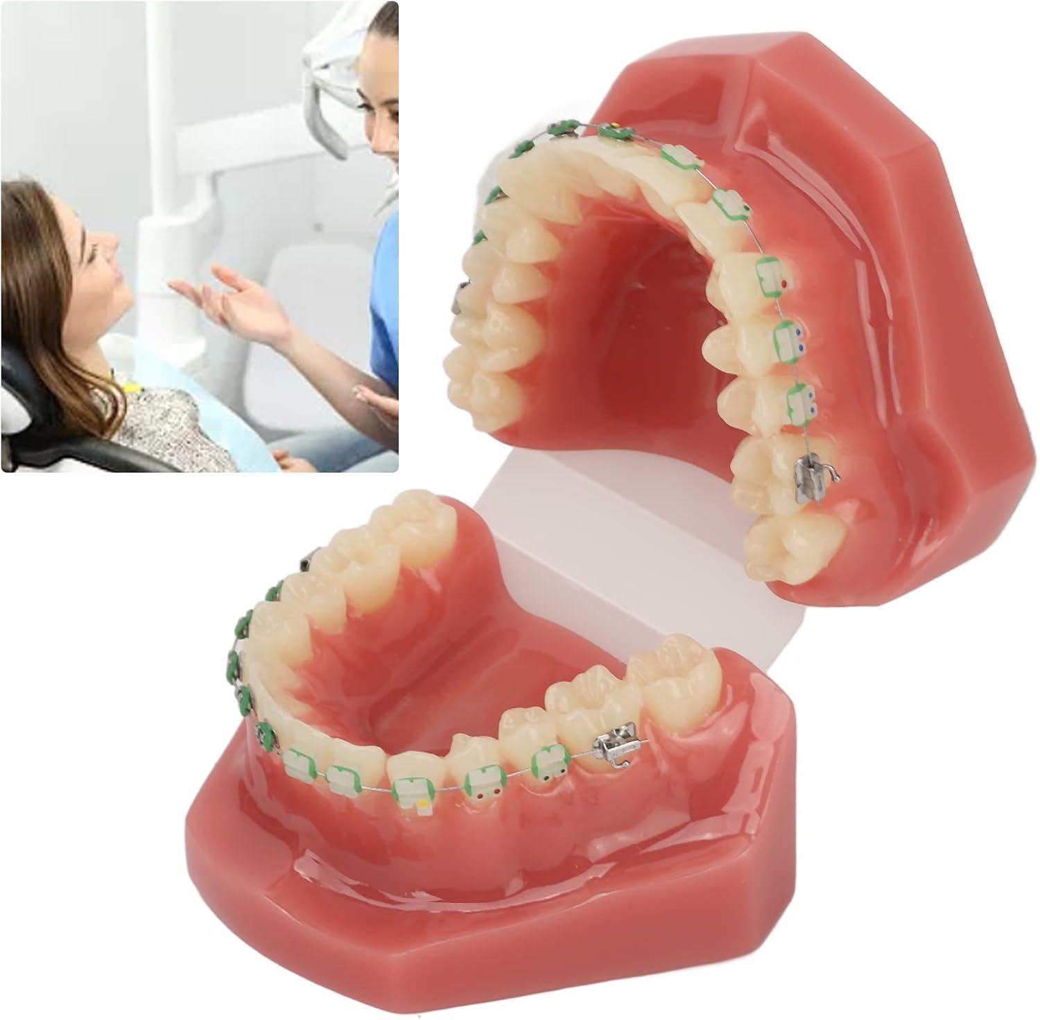 Portable Orthodontic Bracket Model - Simulated Safe Dental Resin for ...