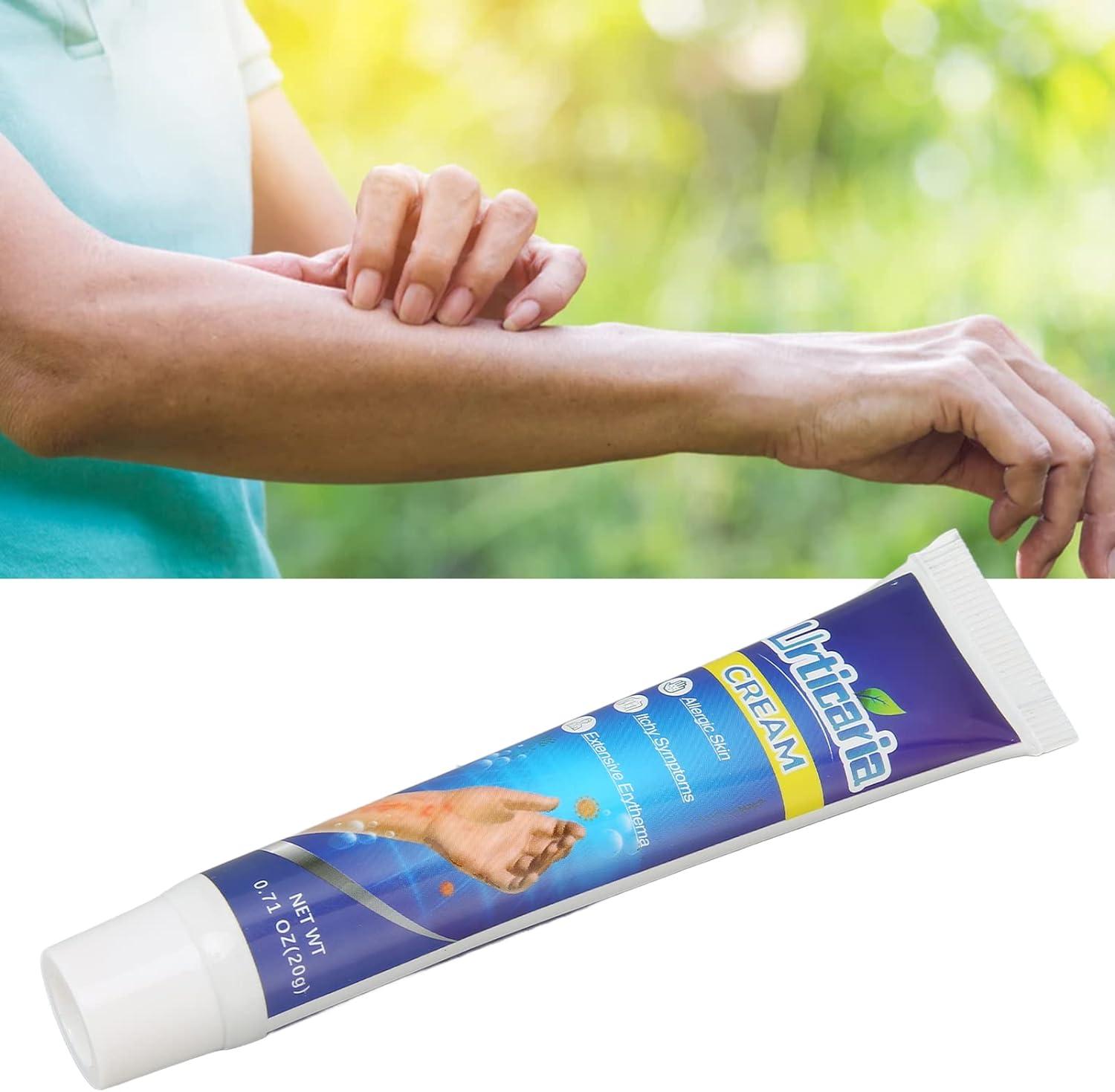 Skin Urticaria Itching Cream - 20g - Pruritus Ointment for Dry Skin