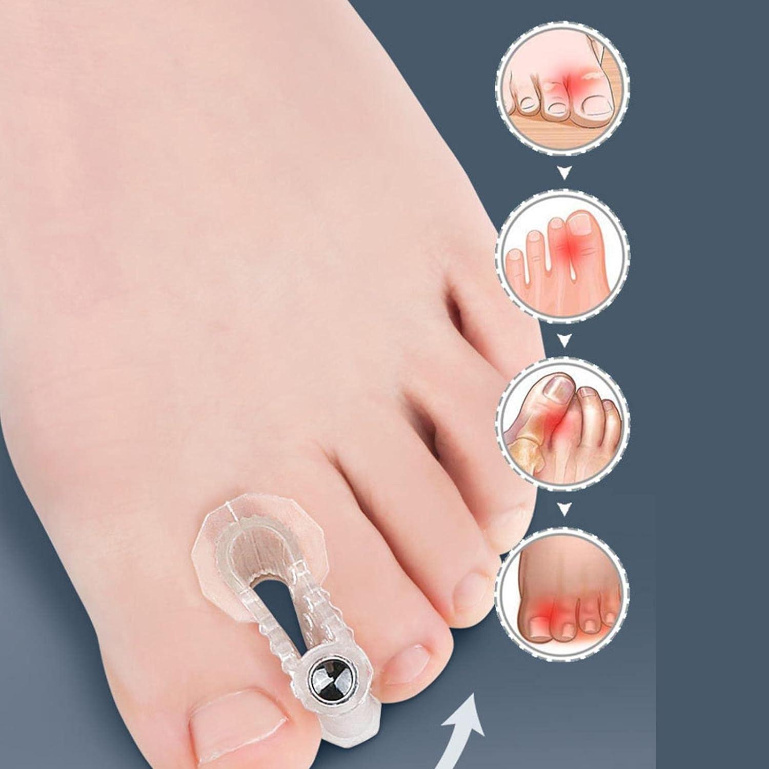 SCOOVY Magnetic Toe Separators - Soft & Comfortable Toe Spacers for ...