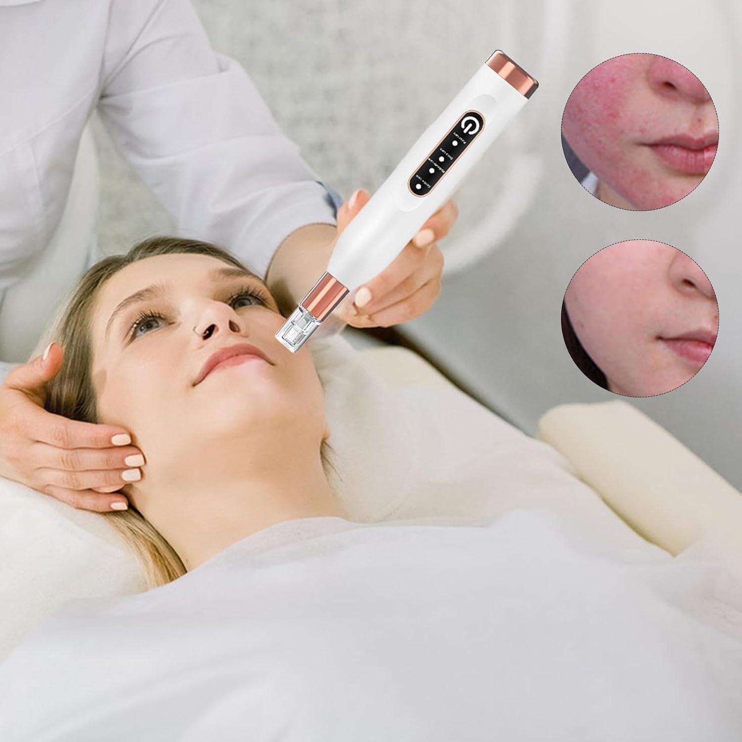 Nano Needling Cordless Electric Derma Auto Electric Derma ...