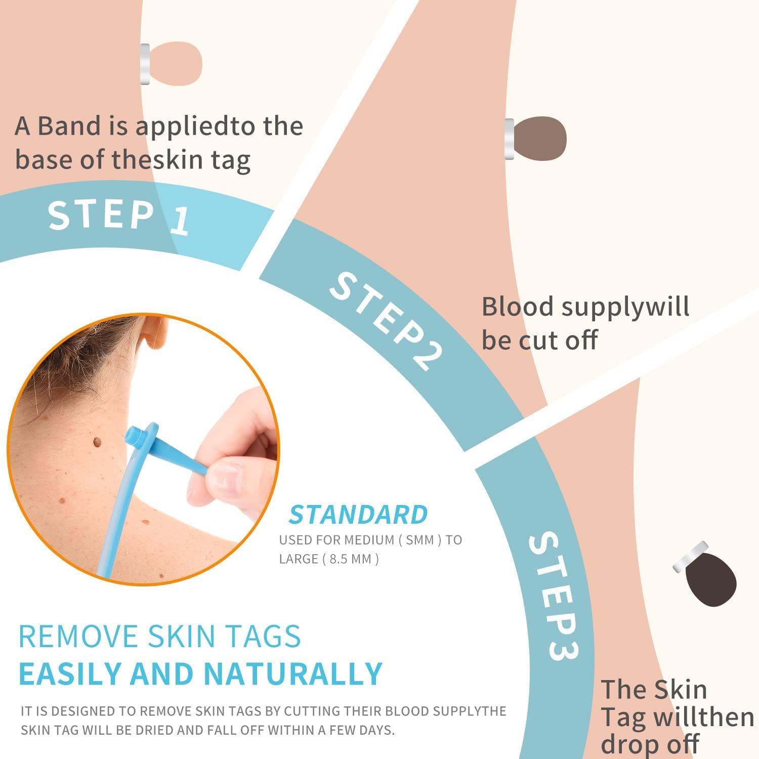 Skin Tag Removal Kit 2-in-1 - Safe & Effective for Small to Large Skin ...