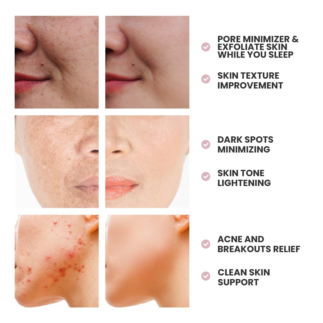 Skin Deva Glycolic Acid Cream - Exfoliate, Brighten, Correct Dark Spots ...