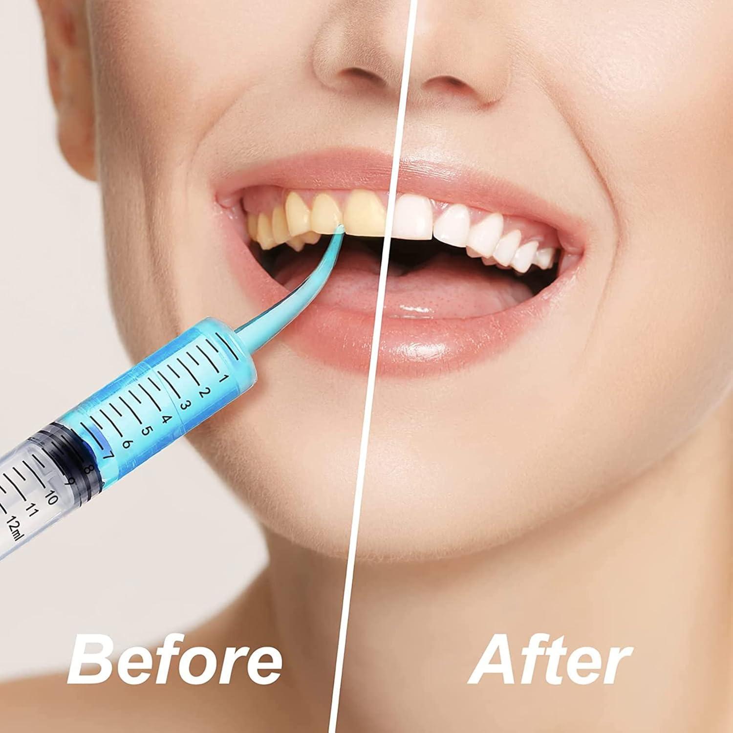 100 Pack & 200 Pack Dental Syringes with Curved Tip - 12ml Disposable ...