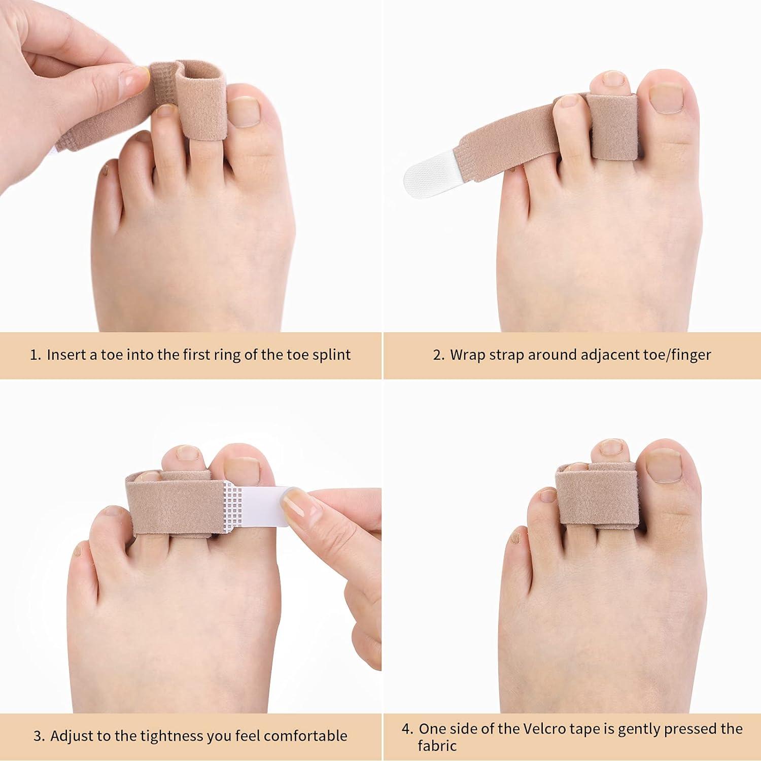 Skisneostype Hammer Toe Splints - 10 Pcs Fabric Toe Splint for ...