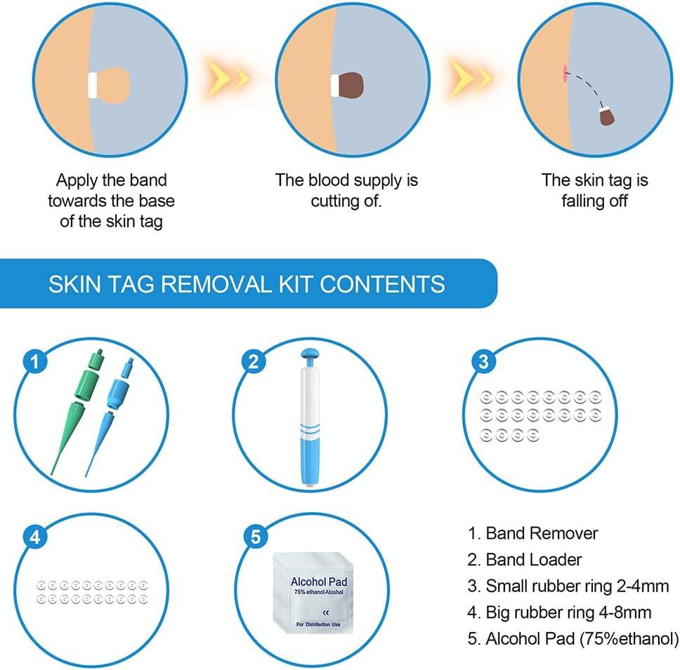 2-in-1 Skin Tag Remover - Painless Automatic Mole & Wart Removal + 40 ...