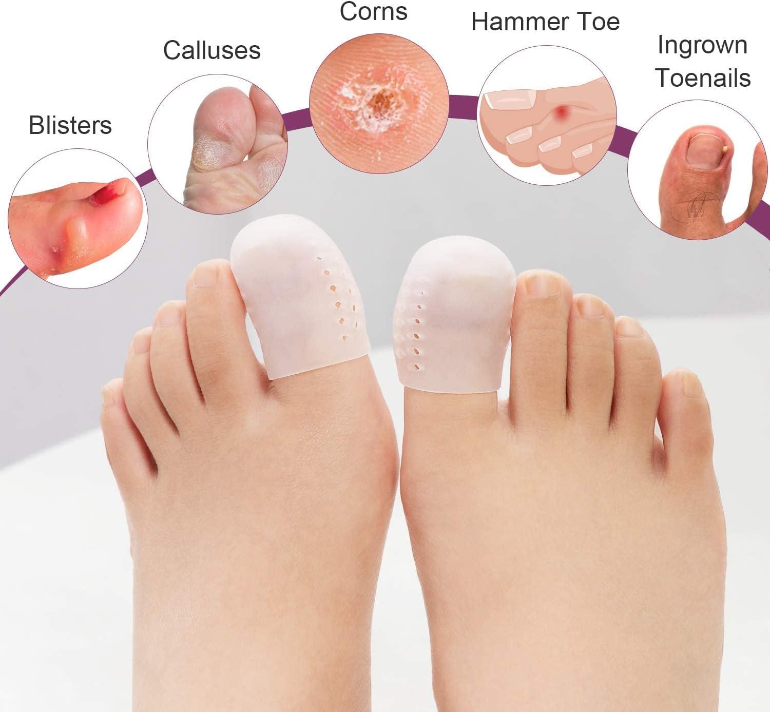 Promifun Gel Toe Cap Protectors - 12 Breathable Toe Shells for Corns ...