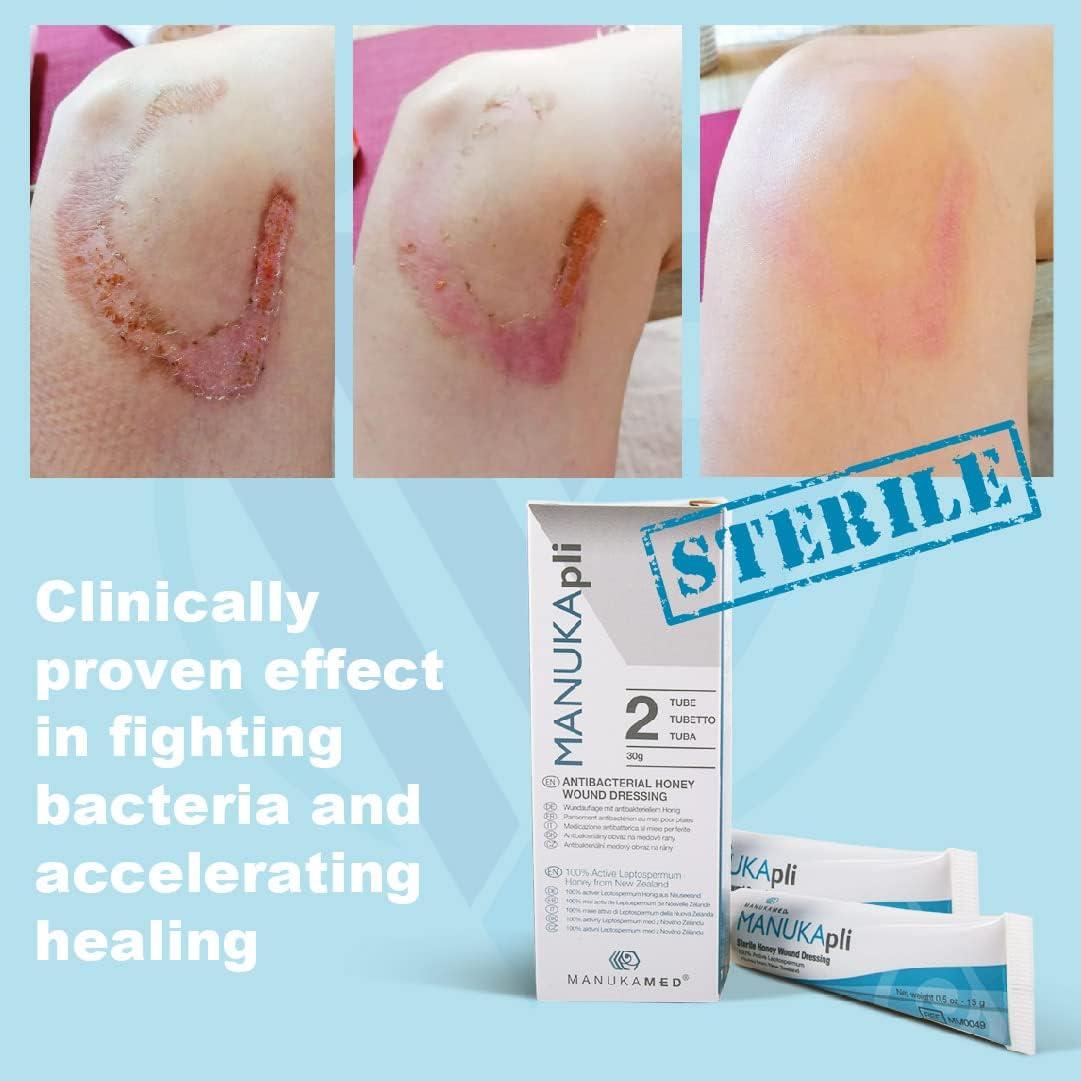 ManukaMed MANUKApli Sterile Wound Dressing 100% Bioactive MGO 560 ...