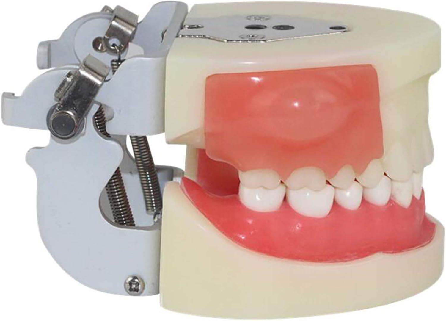 Life-Size Human Teeth & Abscess Model - Perfect for Student Teaching ...