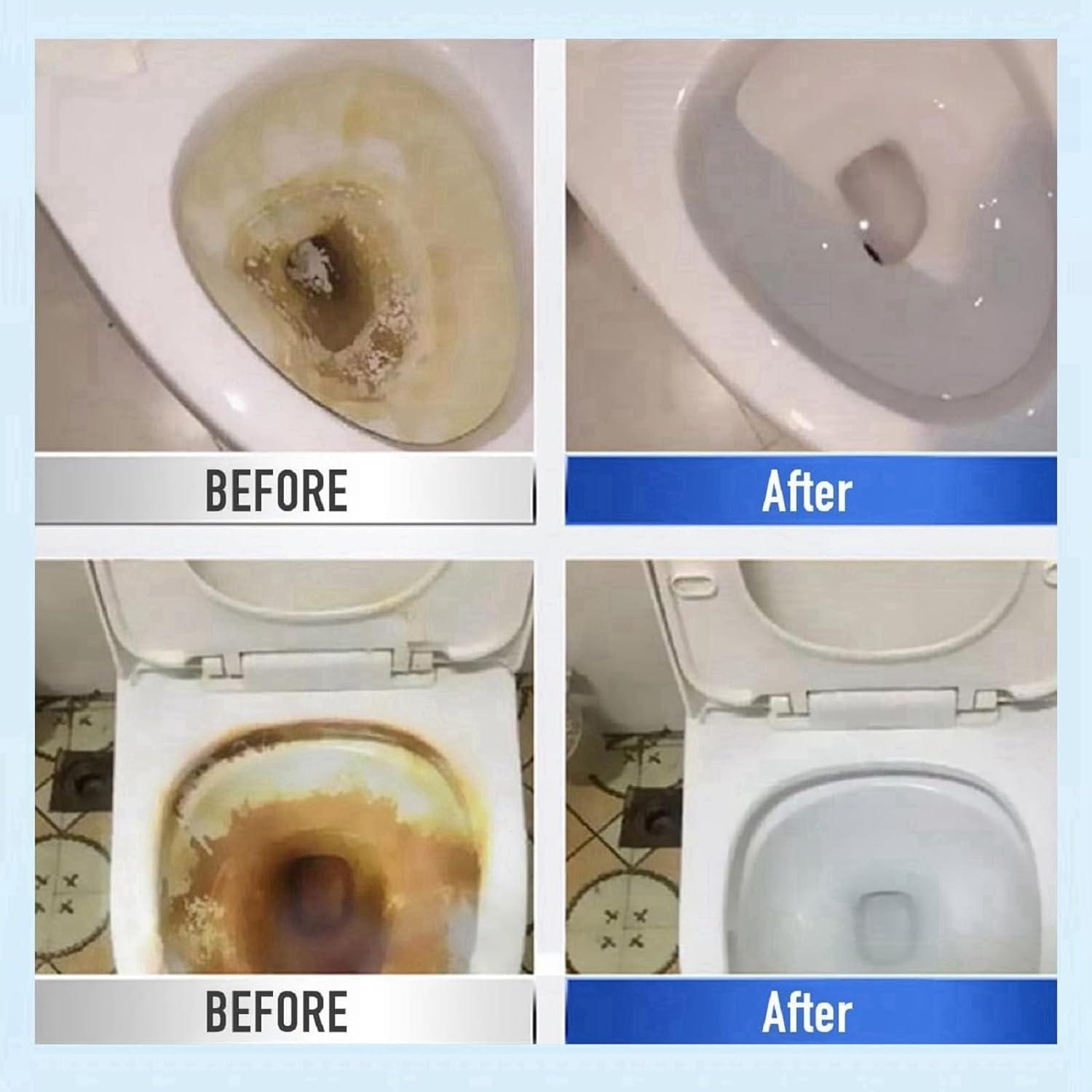 Toilet Bowl Cleaner 12PCS Toilet Limescale Remover Toilet Cleaner ... Toilet Bowl Cleaner 12PCS Toilet Limescale Remover Toilet Cleaner ...