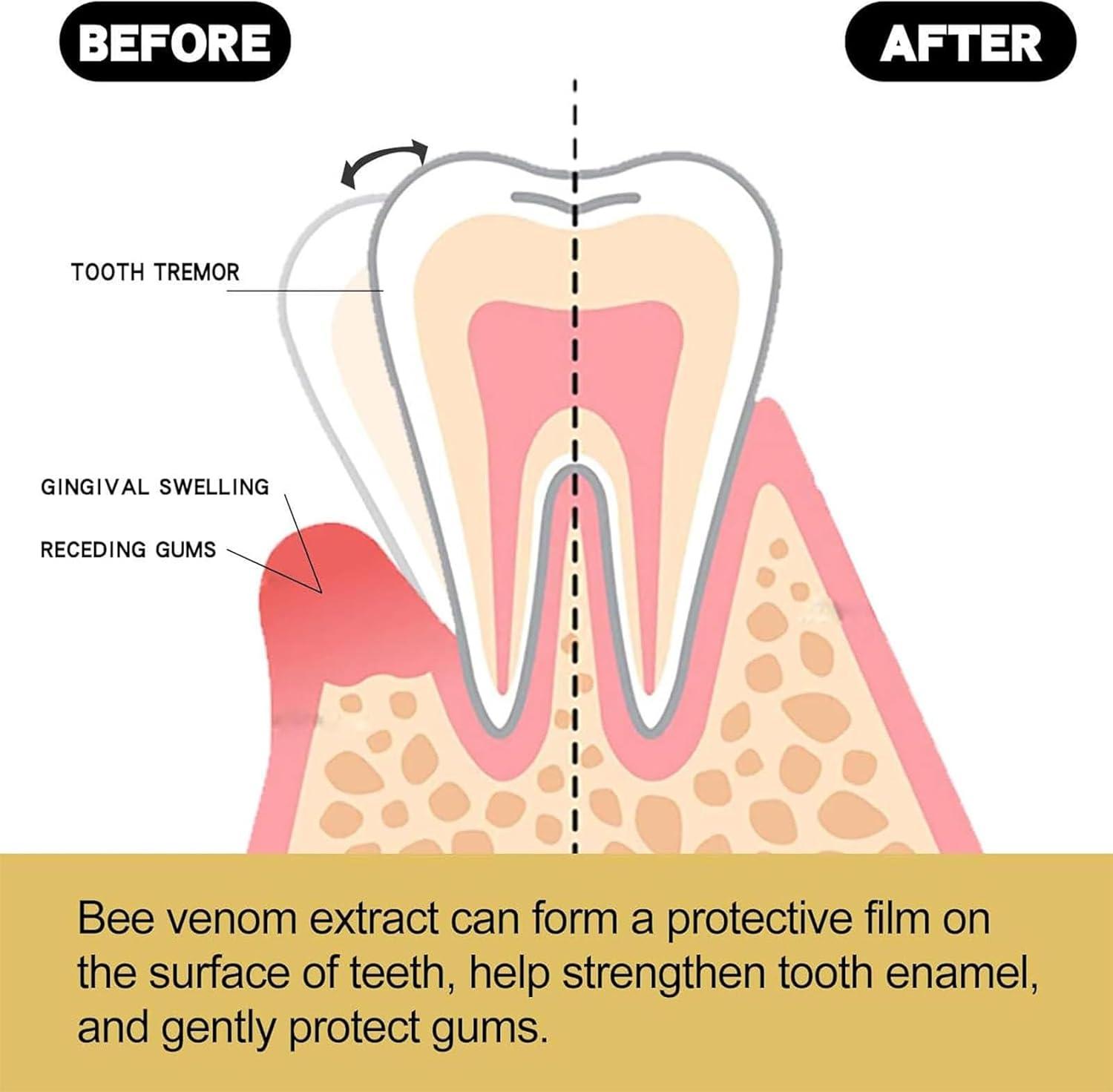 Bee Venom Toothpaste - Deep Clean Gums Remove Stains & Freshen Breath ...