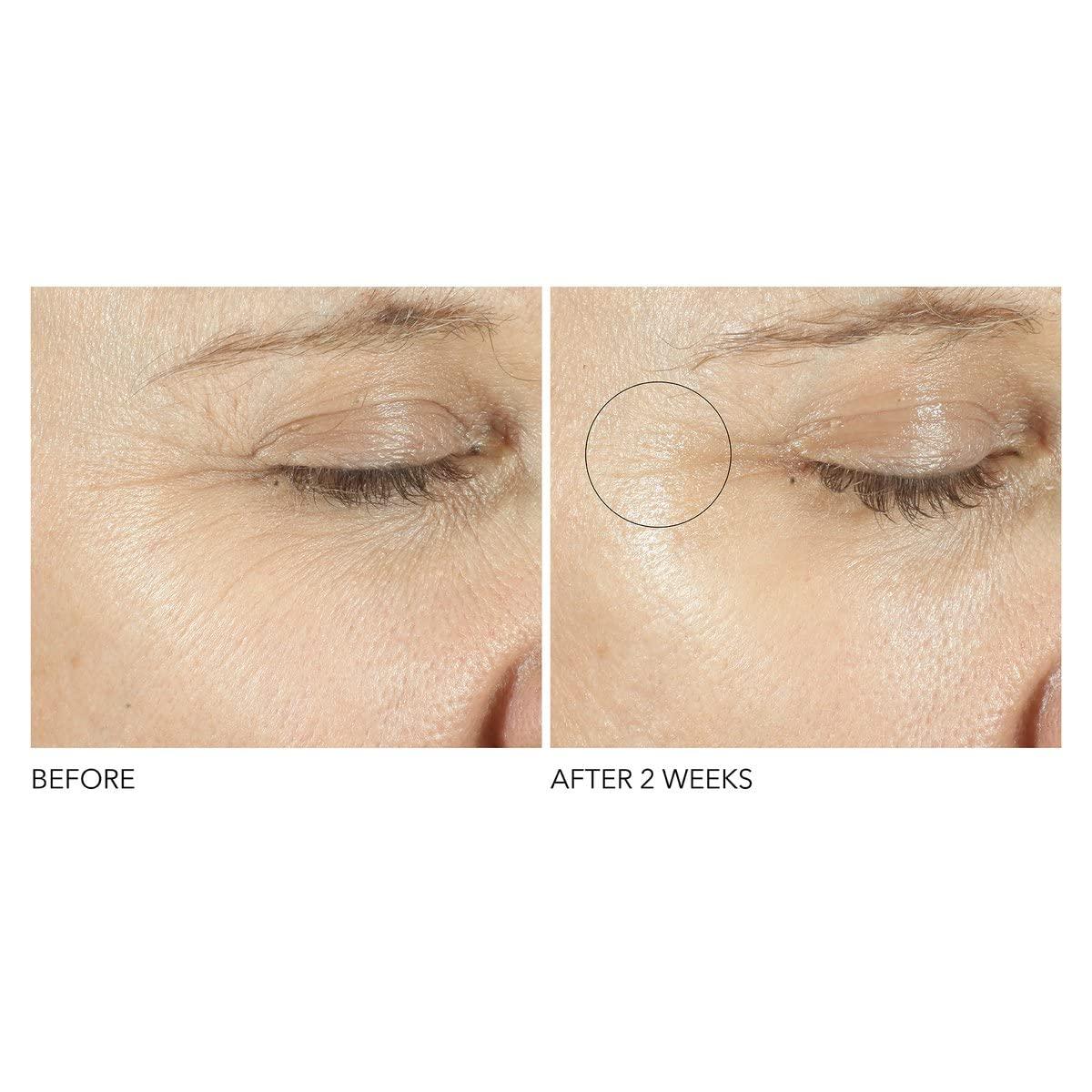 Dr. Dennis Gross Retinol + Ferulic Eye Serum for Firm Skin, Hydration ...