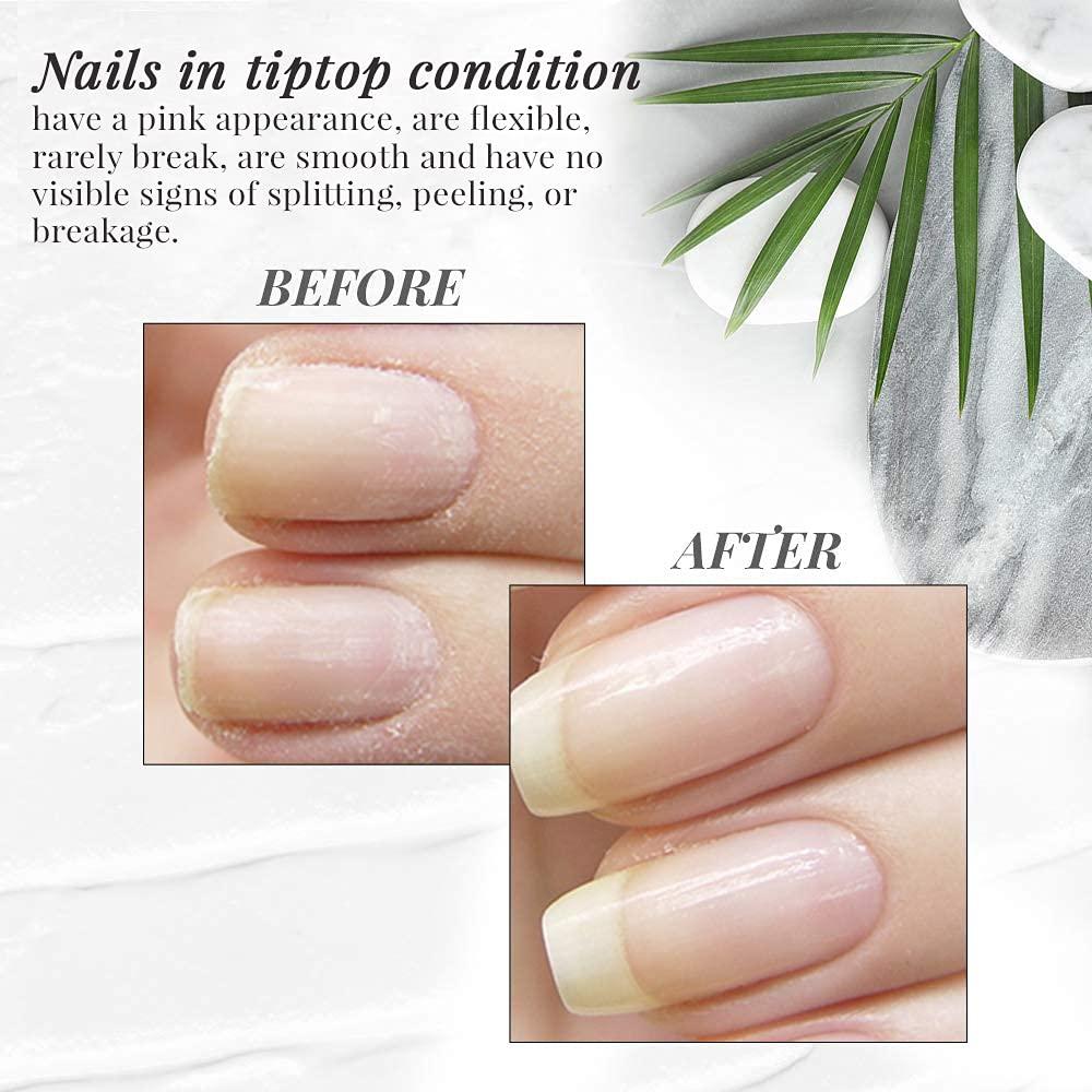 Nail Tek Hydrate 1 Moisturizing Strengthener for Strong, Healthy Nails ...