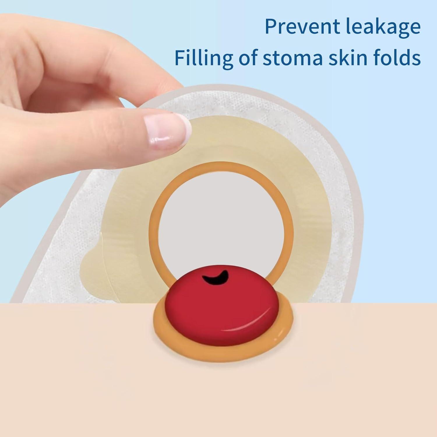 Buy Alcohol-Free Ostomy Paste | Skin Barrier for Stoma Care | Prevent ...