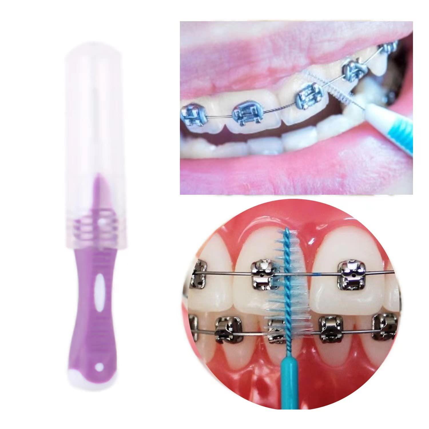 Portable Orthodontic Toothbrush Kit for Braces - Interdental Brush ...