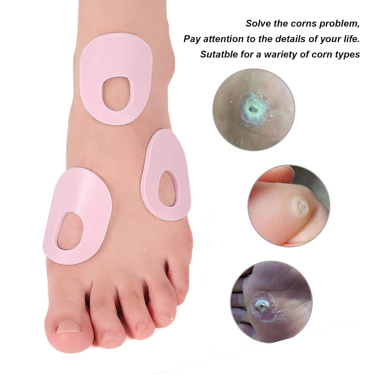 Callus Cushion Corn Pads: Abrasionproof & Breathable Foot Care Solution ...