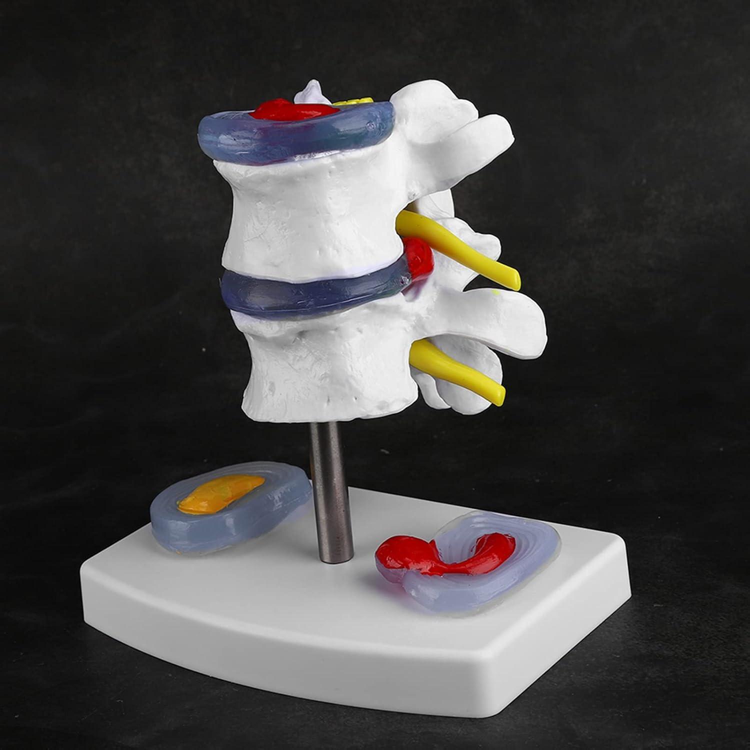 Anatomical Lumbar Intervertebral Disc Model - Spine Demonstration for ...