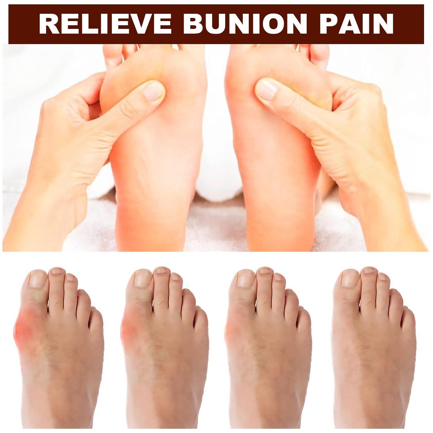 JointCare Anti Bunion Treatment Oil & Roller Set - Bunion Relief Cream ...
