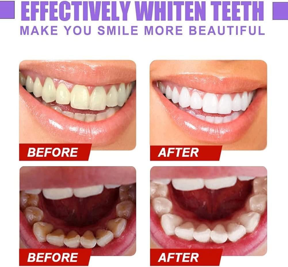 2PCS V34 Colour Corrector Purple Toothpaste for Teeth Whitening and ...
