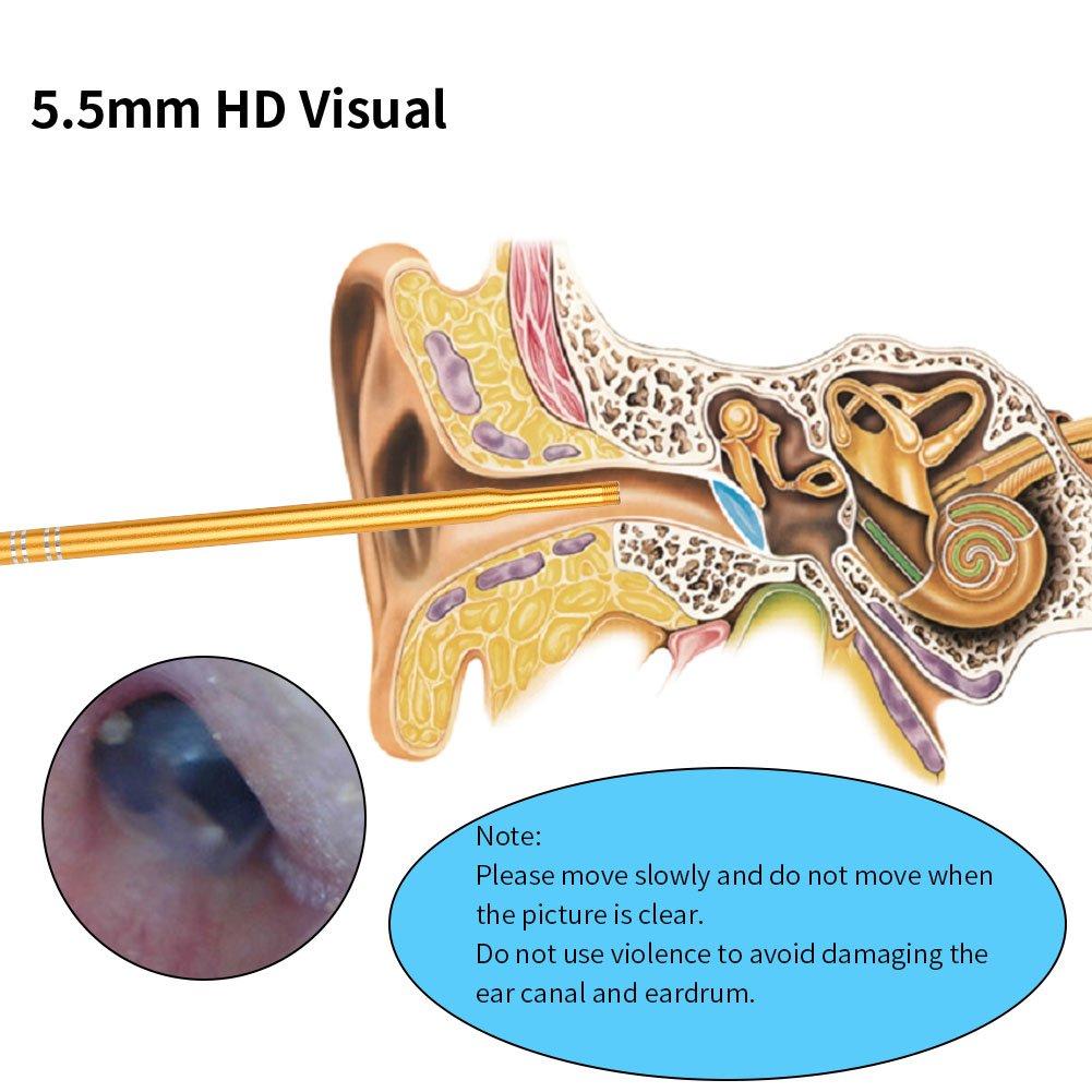 3-in-1 Earwax Removal Kit with Endoscope | Ear Pick & Cleaner | HD ...