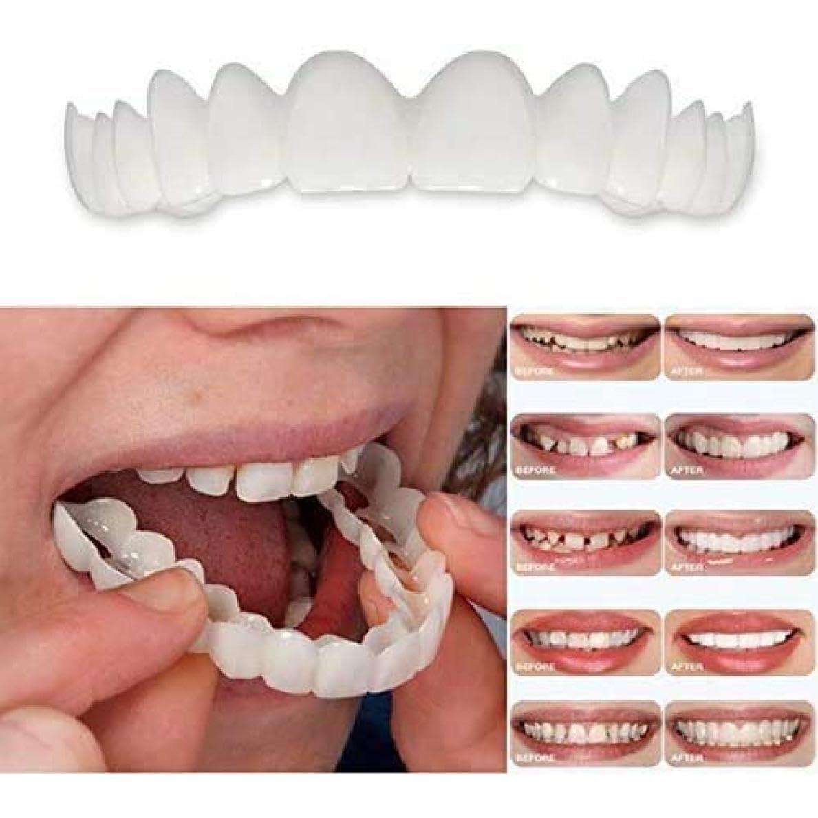 Shop 2 Pairs Cosmetic Dentures - Instant Veneer Teeth for Comfort Fit ...