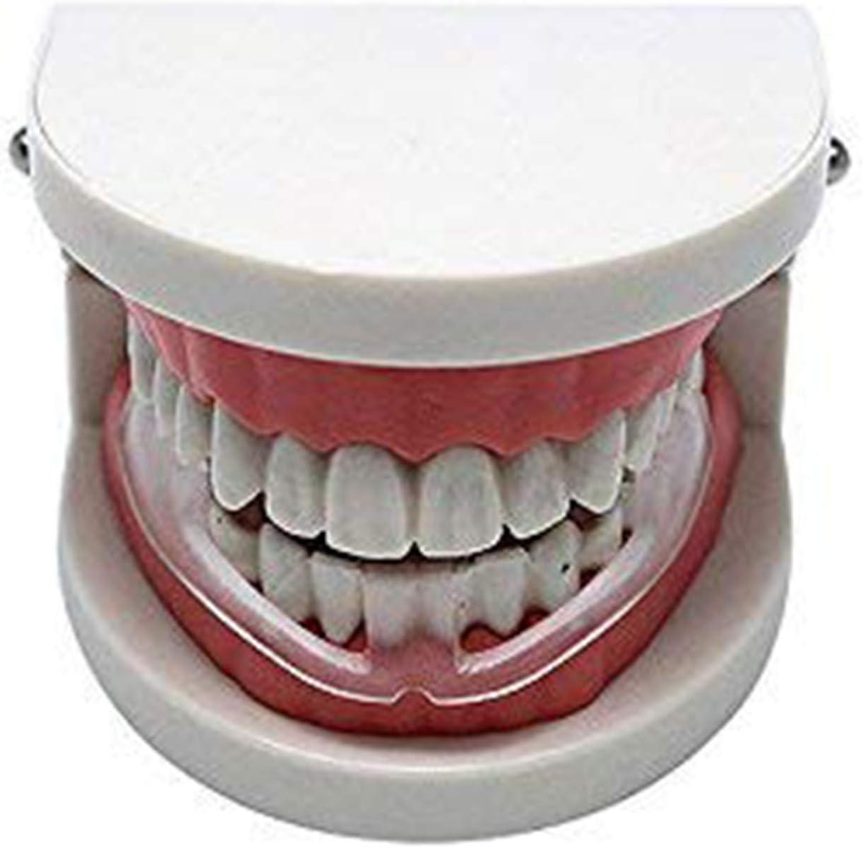 30 Pk Daily TMJ Mouth Guard - Anti Teeth-Grinding Dental Guard for ...
