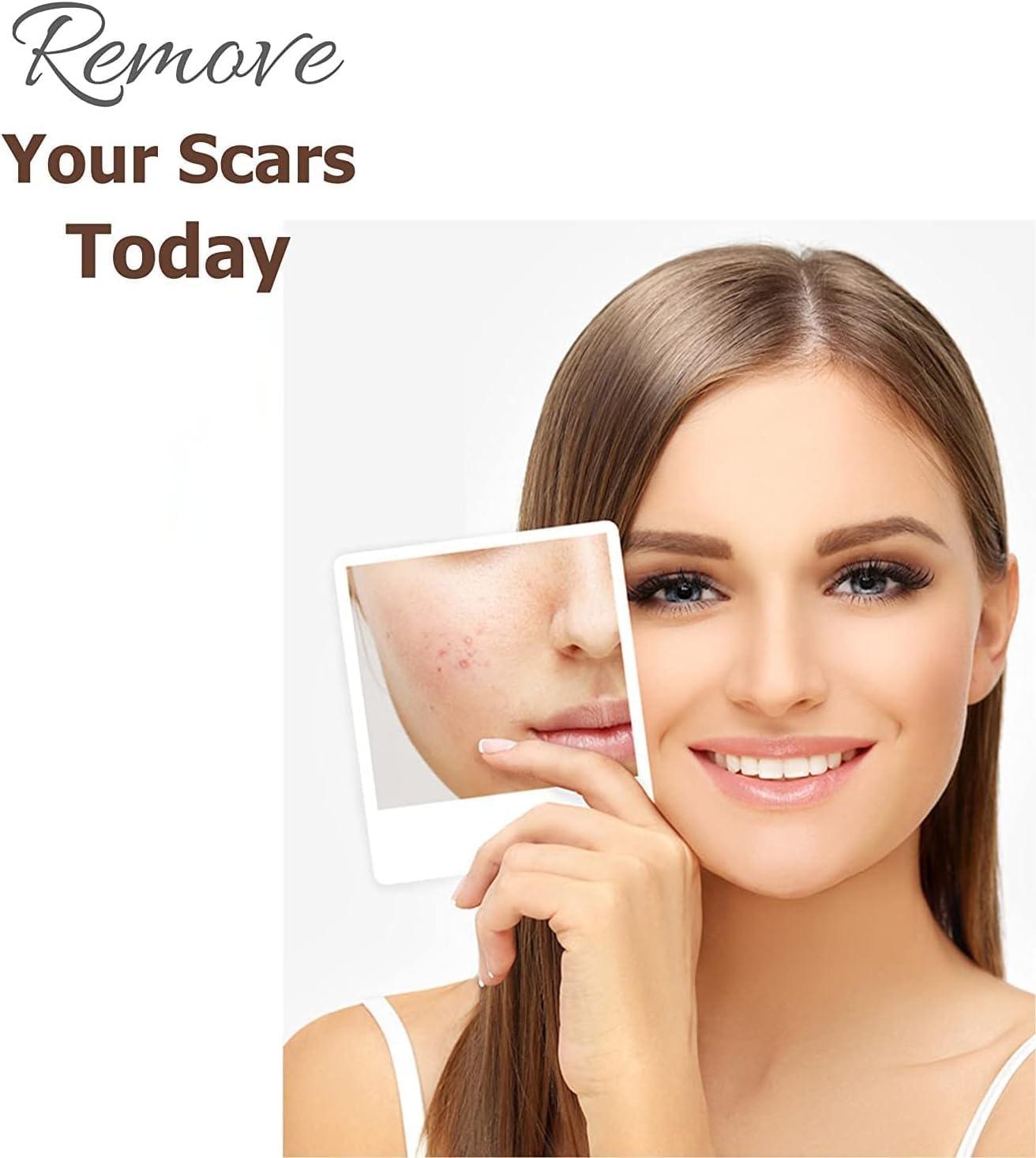 Puritans Beuniq Anti-Scar Gel - Lightens Old & New Skin Scars, Keloids ...