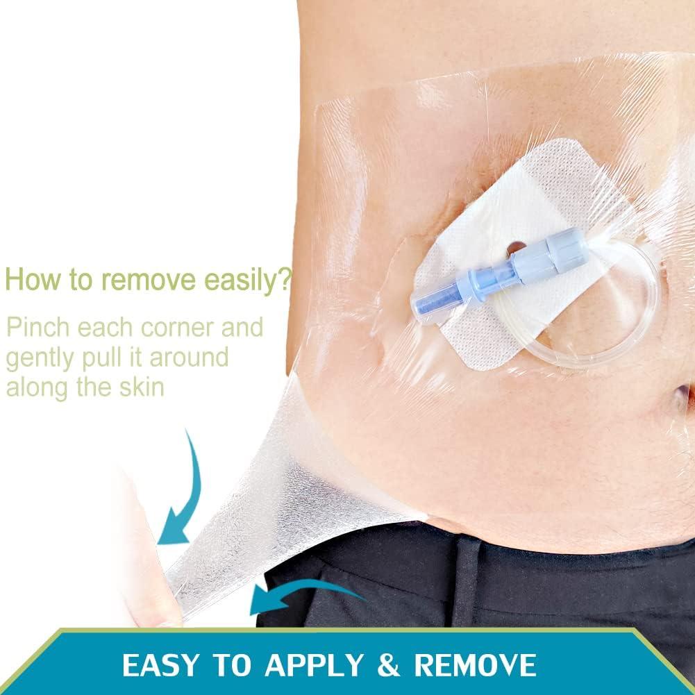 Waterproof Adhesive Bandage Peritoneal Dialysis Catheter Cover 6x197 ...