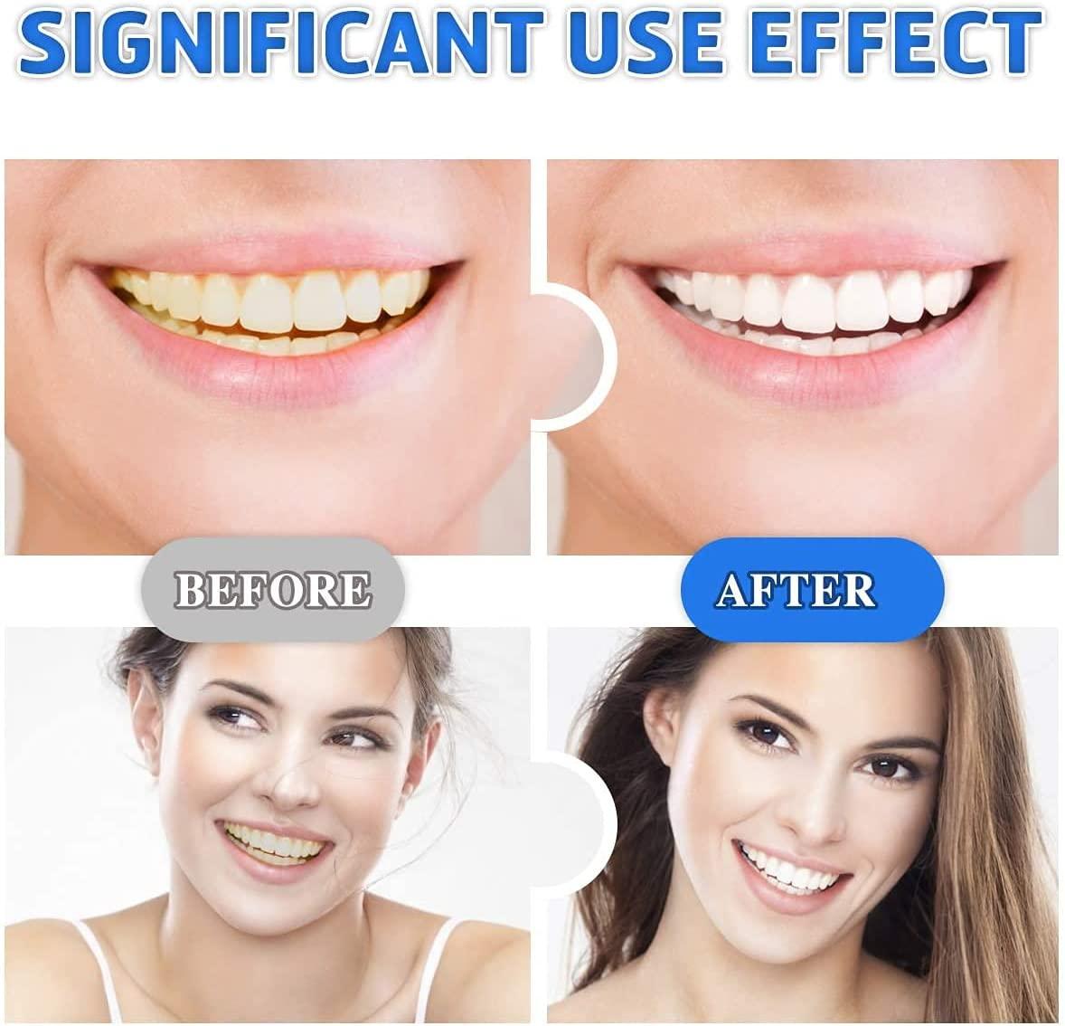 5D Teeth Whitening Strips by ifanze - Safe & Effective Kit with 14 ...