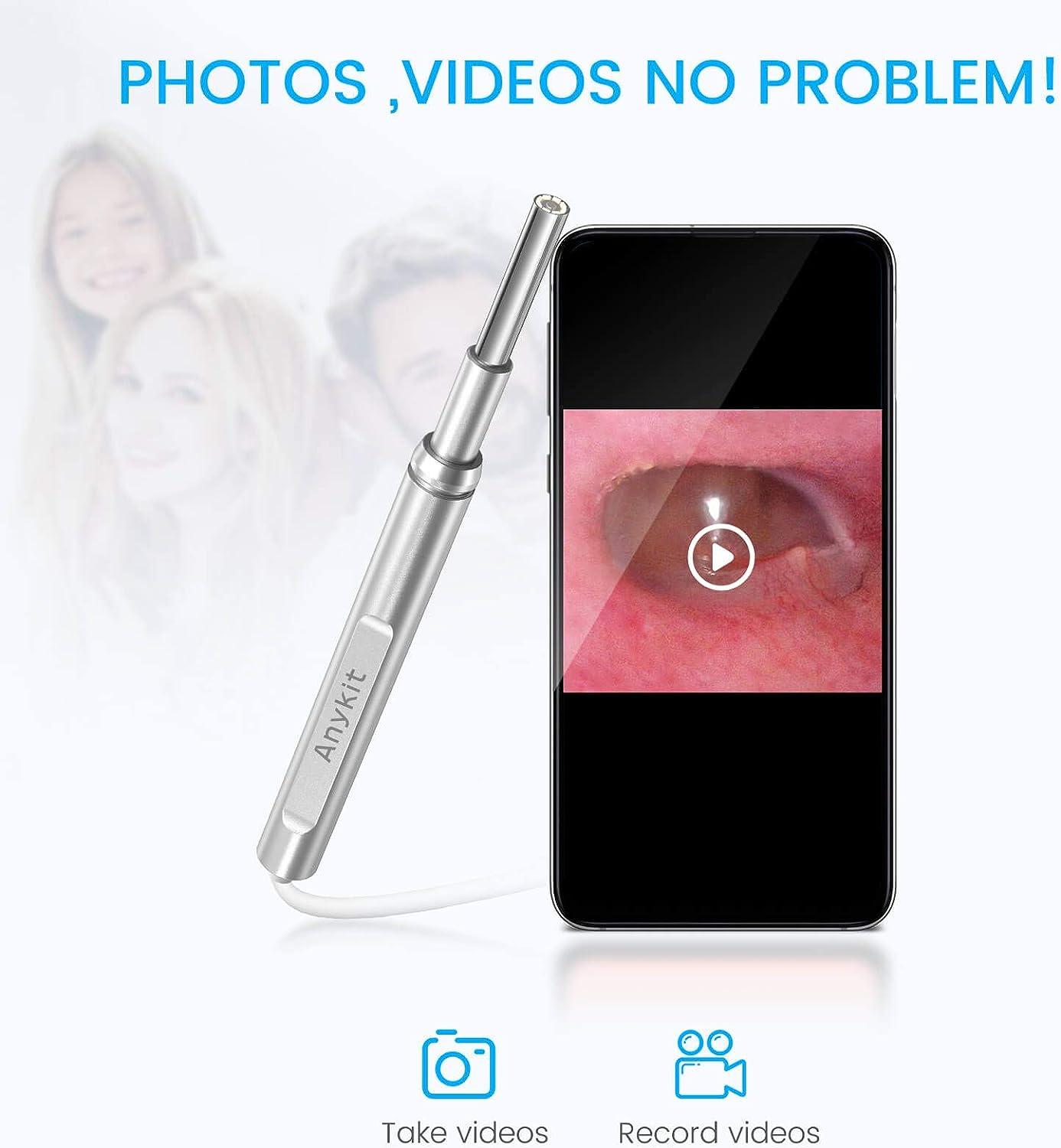 Anykit USB Otoscope for PC & Android Ultra Clear View Ear Camera with ...