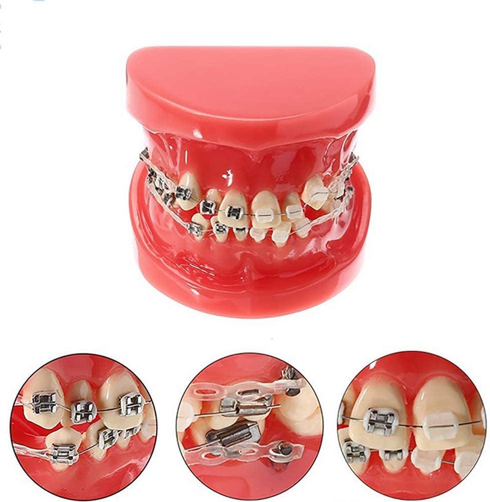 Orthodontic Braces Model Doll-10 - Ceramic Teeth Study for Adults ...