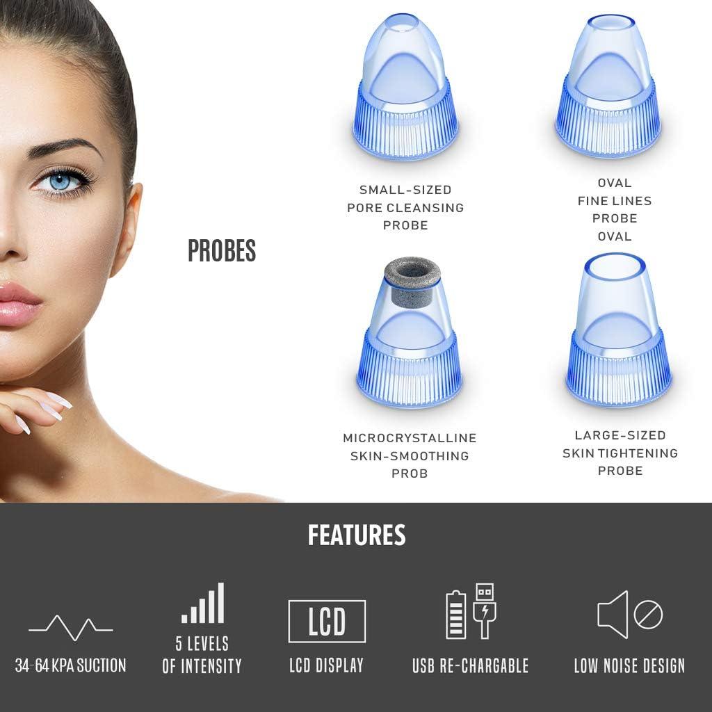 Blackhead and Whitehead Remover Pore Vacuum - BlueOrchids Dermasuction ...