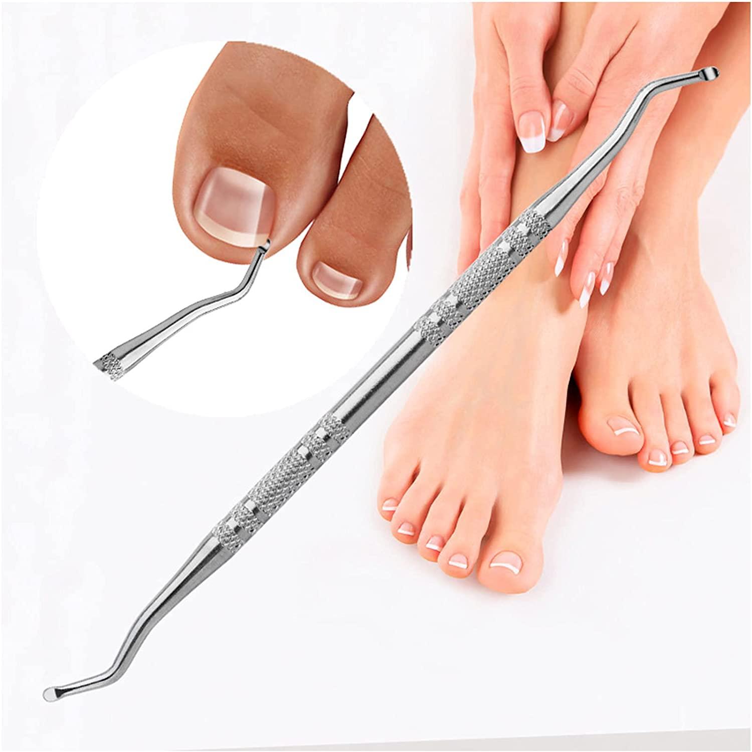 Ingrown Toenail Correction Treatment Kit - 30PCS Corrector Strips Brace ...