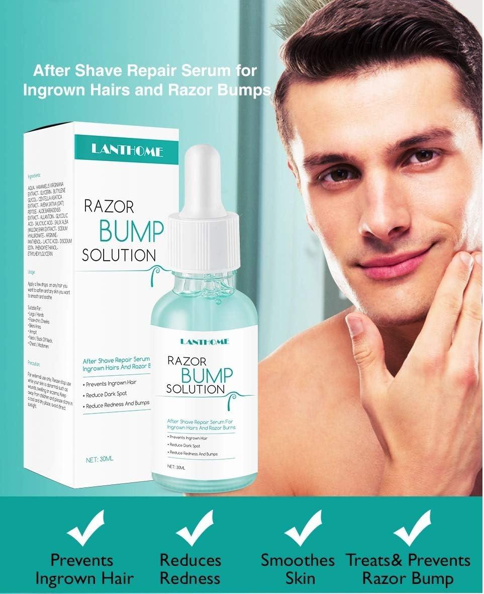 Razor Bumps Solution Skin Ingrown Hair Solution Bumps Reduce Redness ...