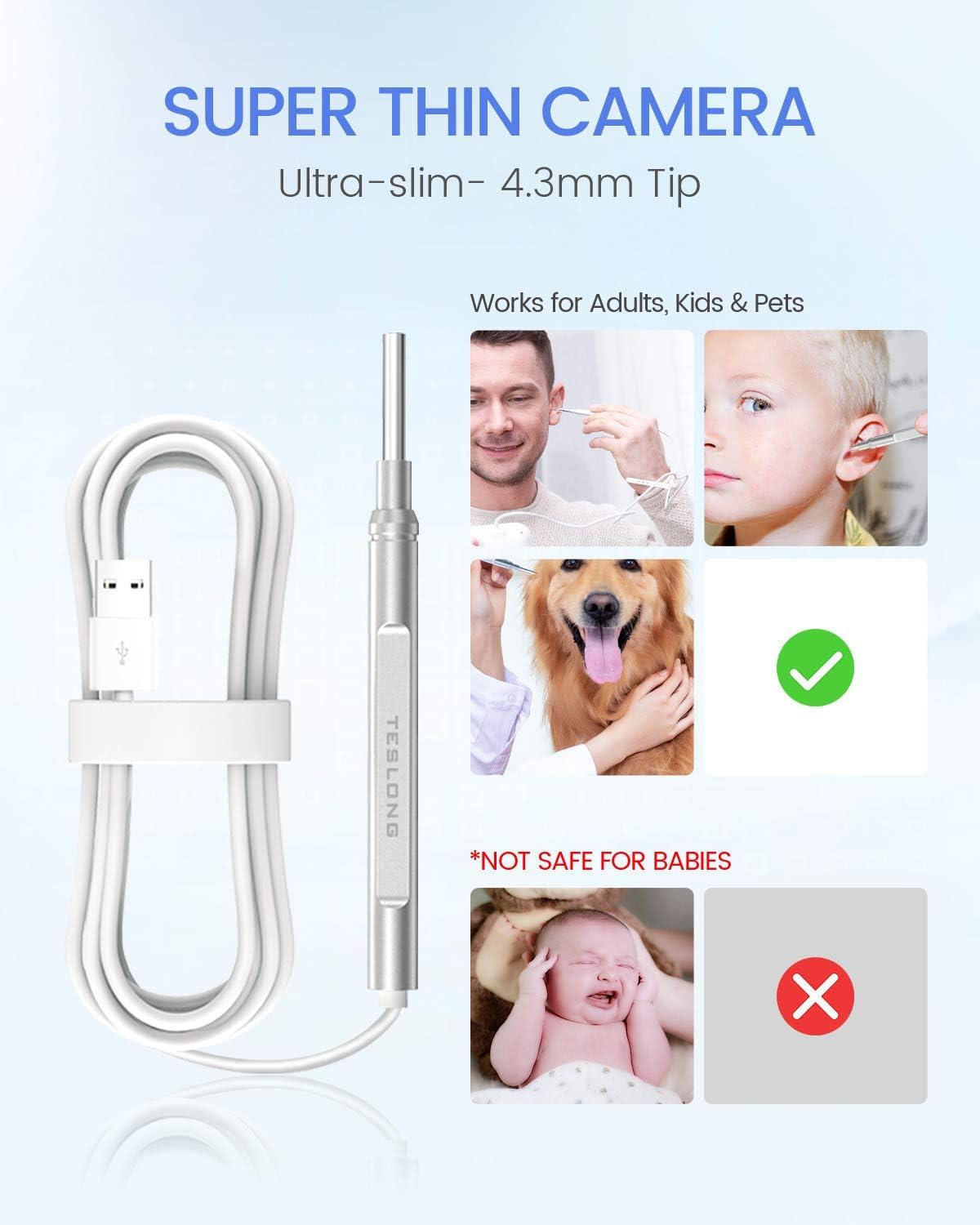Otoscope iPhone 720P HD Digital Ear Scope Camera for iPhone iPad ...