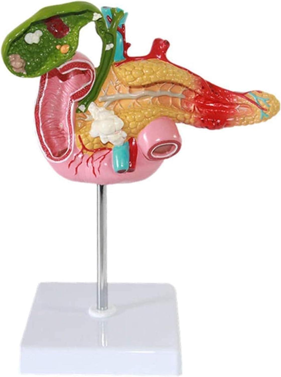 Duodenal Biliary and Pancreatic Model - Duodenal Model - Gallbladder ...