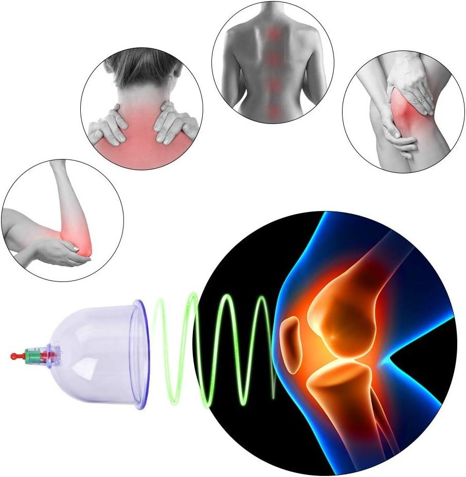 NIMOA Cupping Suction Cups - Traditional Chinese Cupping Massage ...